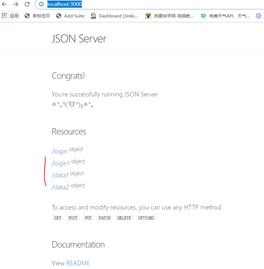 json-server（轻量自定义开发接口） - cherry_ning - 博客园